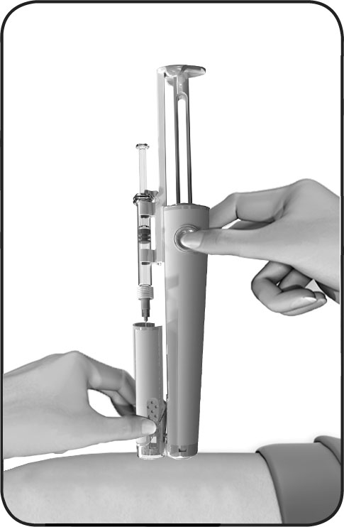 90 ReusableXL | Union Medico